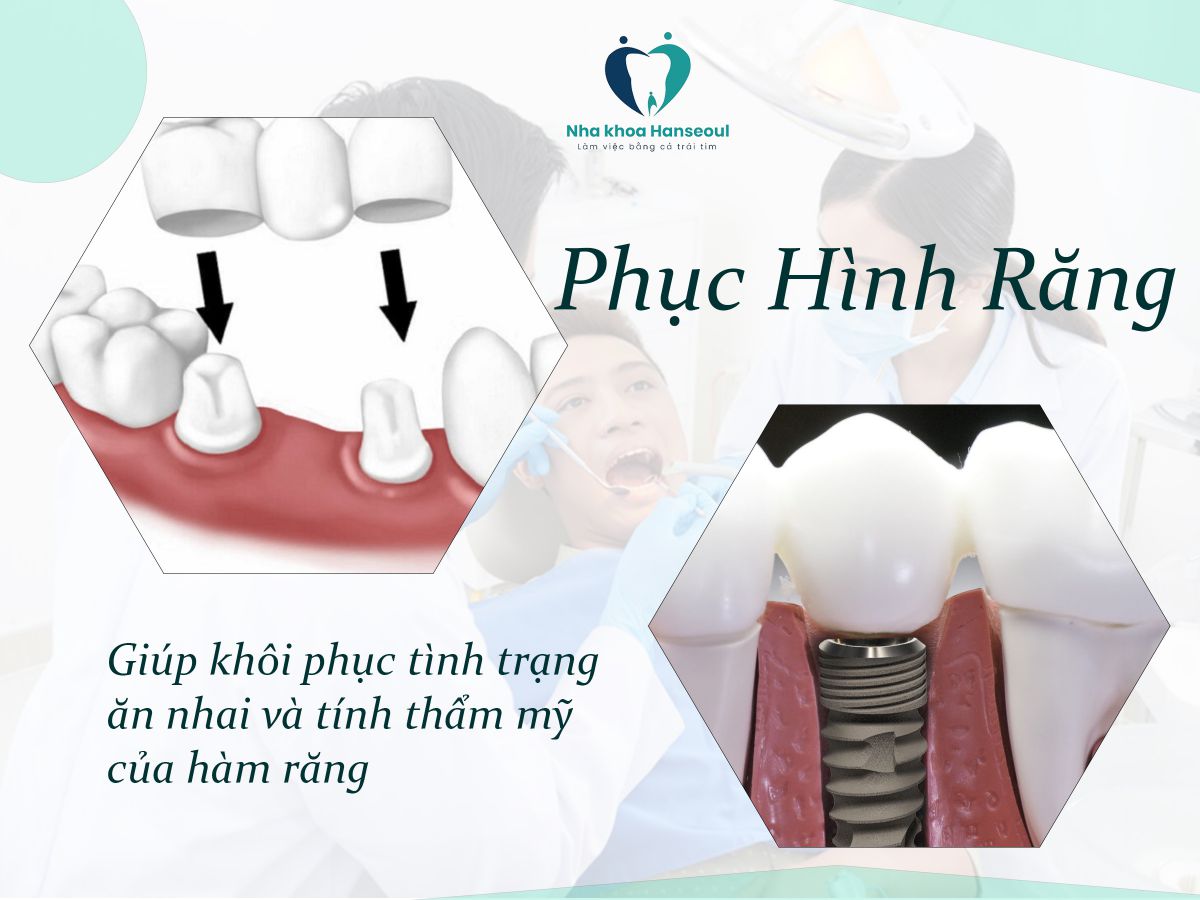 Phục hình răng và các phương pháp thực hiện
